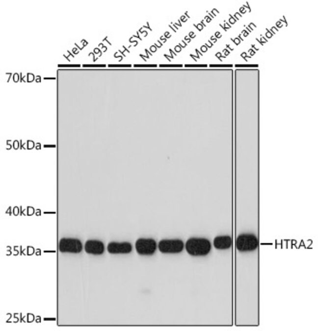 HTRA2 Recombinant Rabbit Monoclonal Antibody (ARC0864), Invitrogen 100 ...