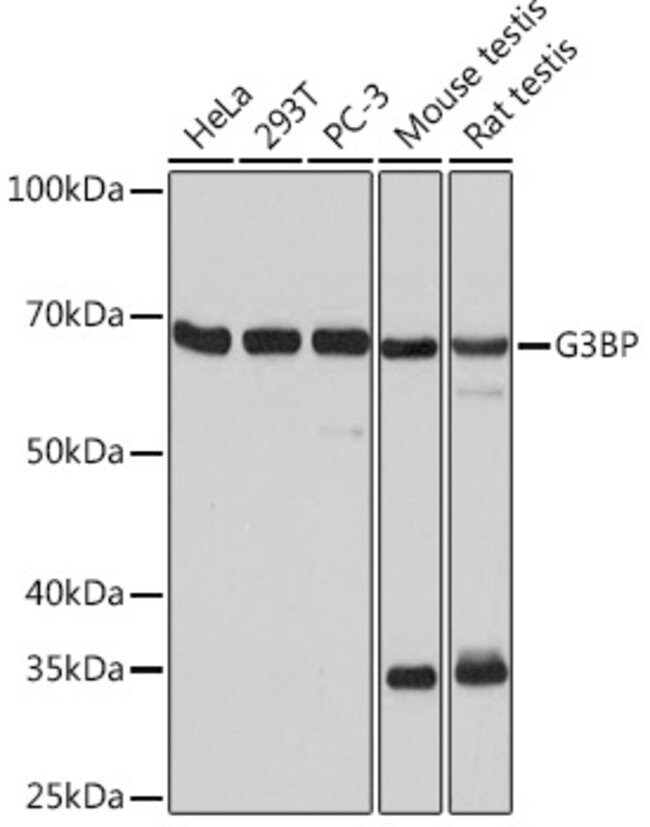 G3BP1 Recombinant Rabbit Monoclonal Antibody (ARC0875), Invitrogen 100 ...
