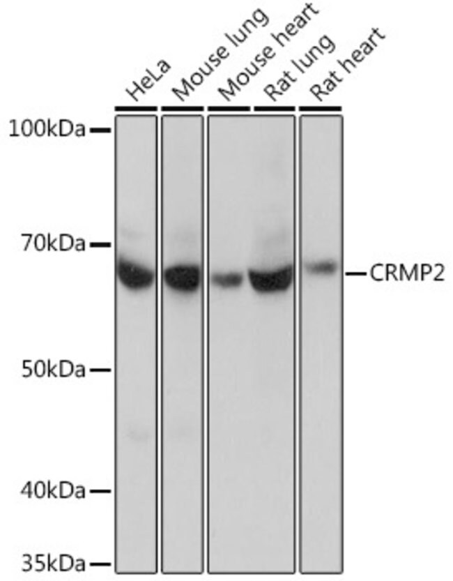 CRMP2 Recombinant Rabbit Monoclonal Antibody (ARC1123), Invitrogen 100 ...
