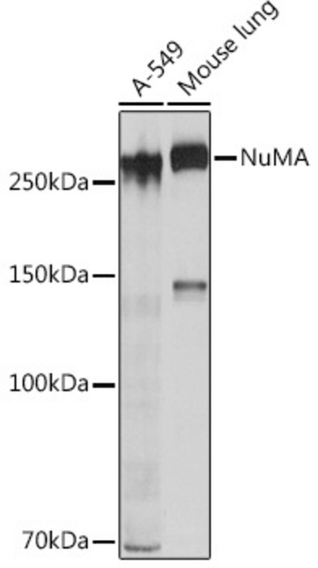 NuMA Recombinant Rabbit Monoclonal Antibody (ARC1000), Invitrogen 100 ...