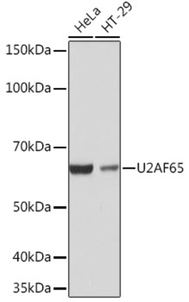 U2AF2 Recombinant Rabbit Monoclonal Antibody (ARC1029), Invitrogen 100 ...