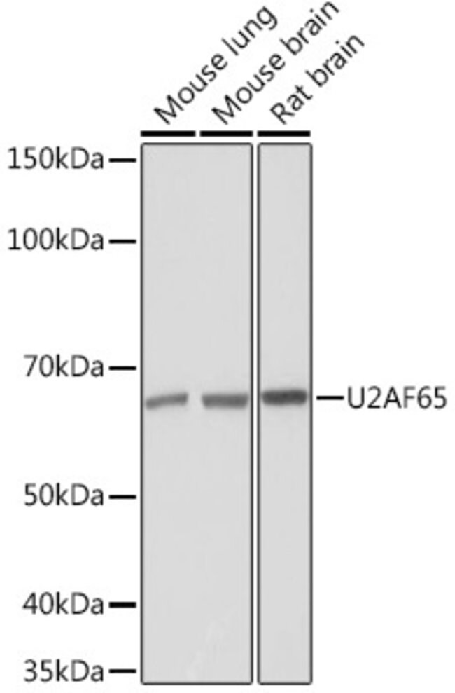 U2AF2 Recombinant Rabbit Monoclonal Antibody (ARC1029), Invitrogen 100 ...