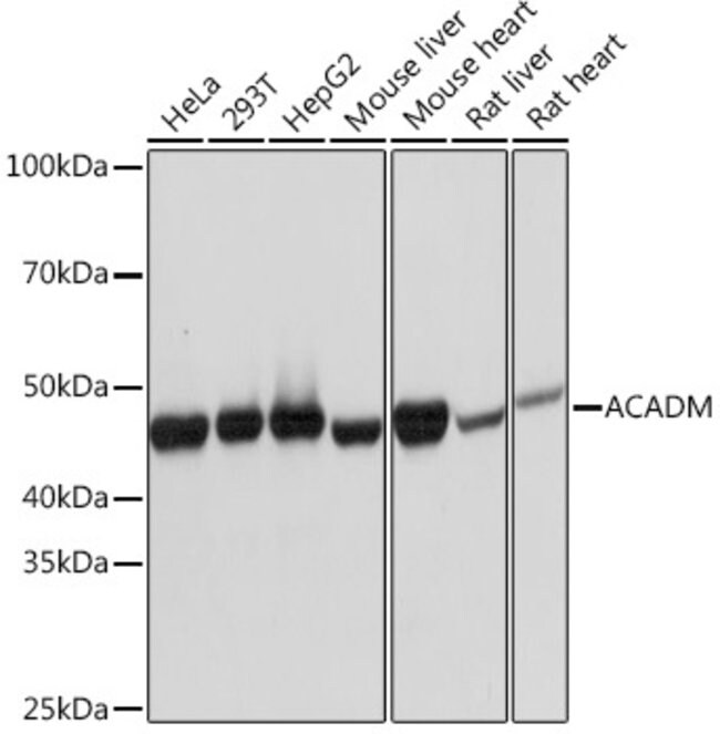 ACADM Recombinant Rabbit Monoclonal Antibody (ARC1035), Invitrogen 100 ...
