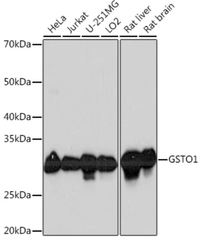 Invitrogen GST Omega 1 Recombinant Rabbit Monoclonal Antibody (7L9P3 ...