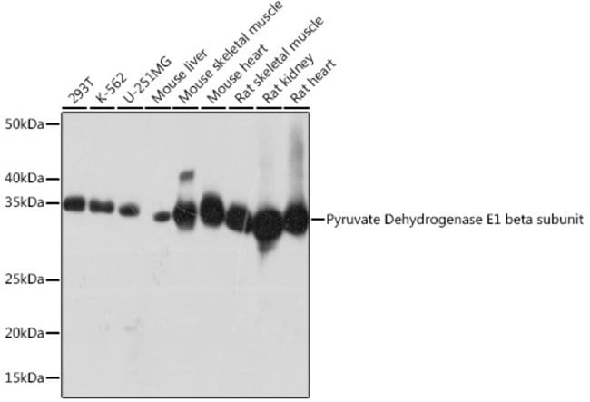 PDHB Recombinant Rabbit Monoclonal Antibody (ARC1074), Invitrogen 100 ...