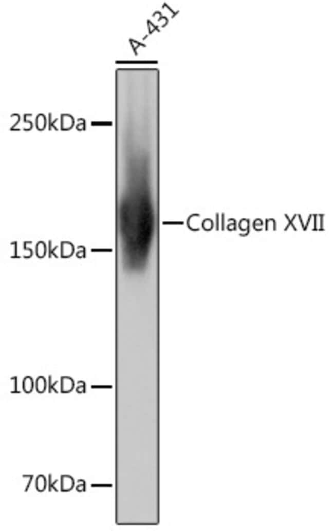 COL17A1 Recombinant Rabbit Monoclonal Antibody (ARC0233), Invitrogen ...