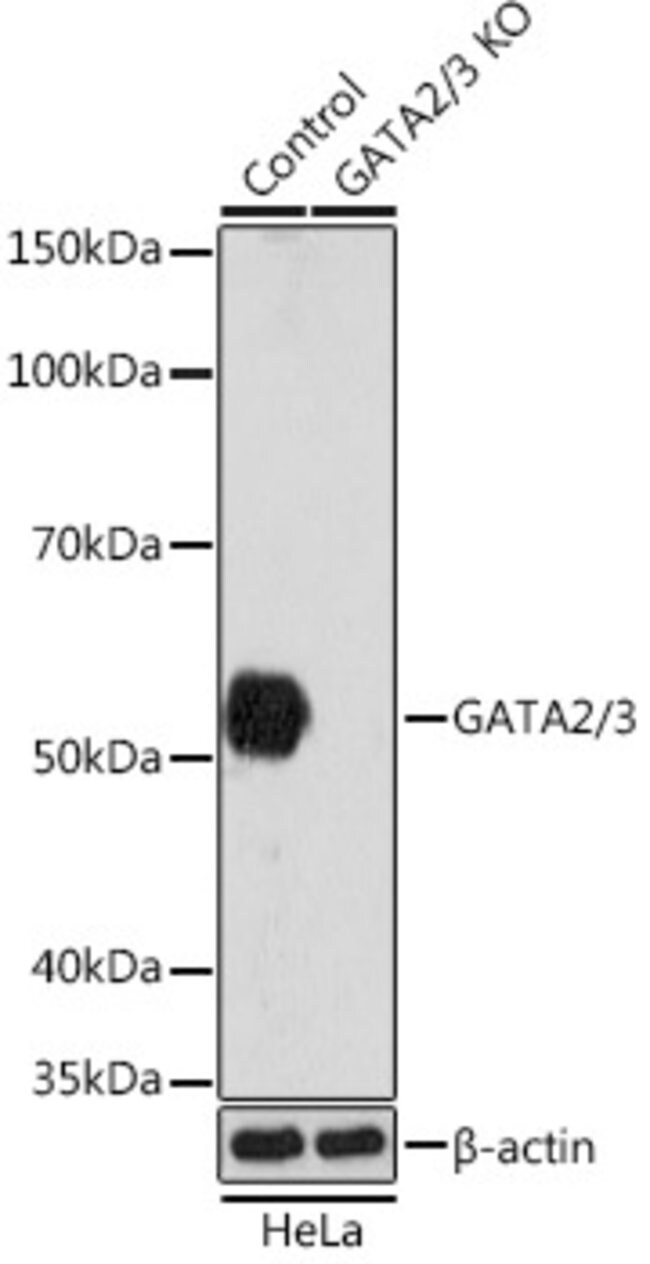 GATA2/GATA3 Rabbit anti-Human, Mouse, Rat, Unconjugated, Clone: ARC1209 ...