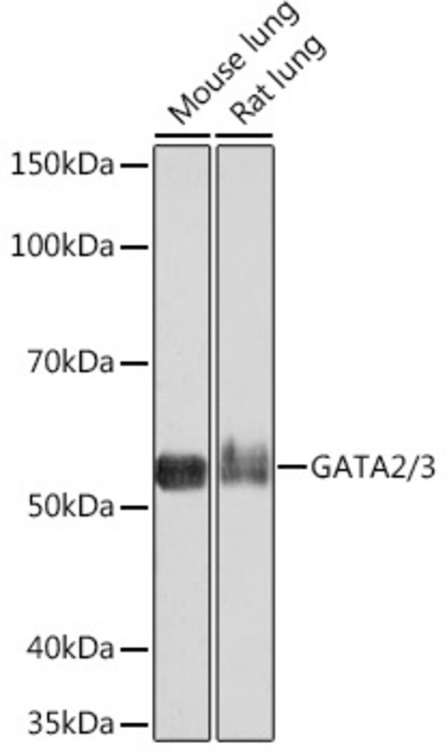 GATA2/GATA3 Rabbit anti-Human, Mouse, Rat, Unconjugated, Clone: ARC1209 ...