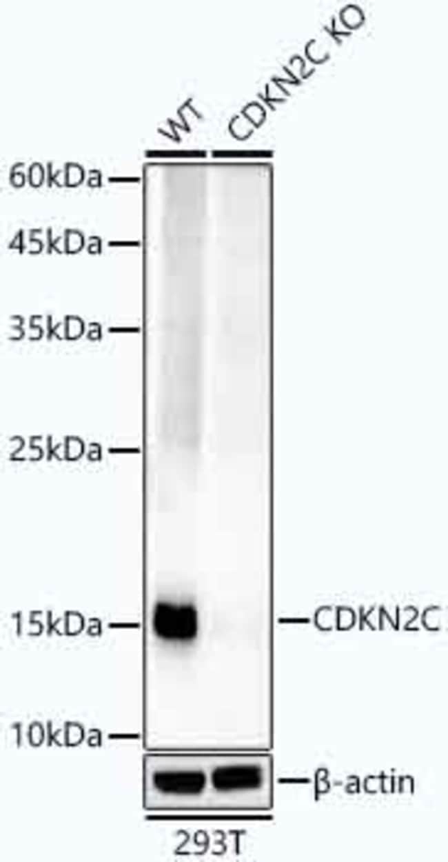 Invitrogen CDKN2C Recombinant Rabbit Monoclonal Antibody (1Q10Q4) 100 ...