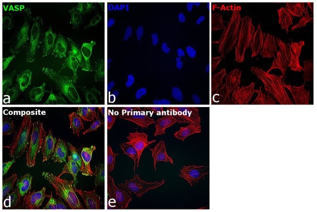 VASP Recombinant Rabbit Monoclonal Antibody (ARC1329), Invitrogen 100 ...