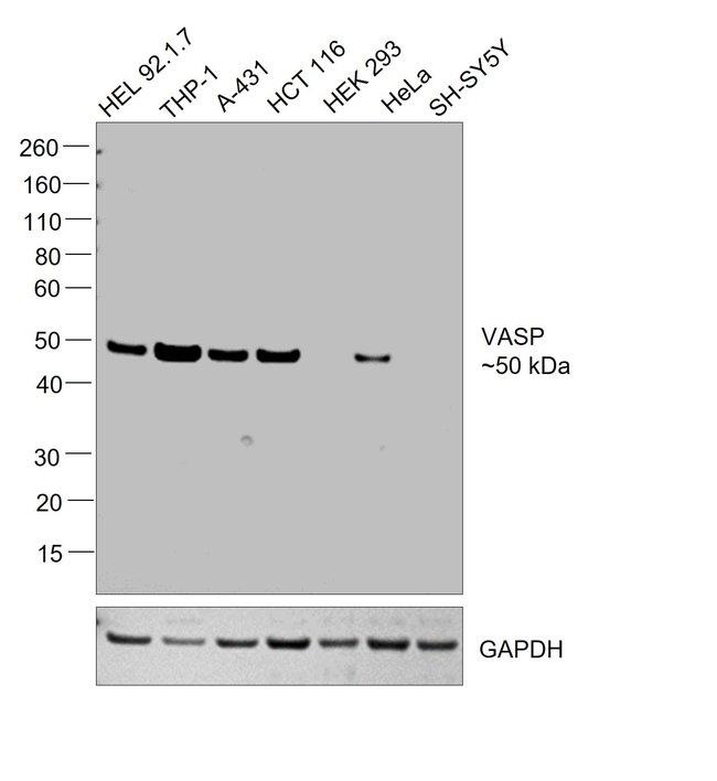 VASP Recombinant Rabbit Monoclonal Antibody (ARC1329), Invitrogen 100 ...