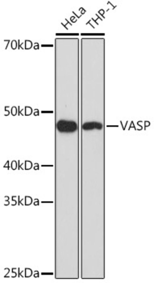 VASP Recombinant Rabbit Monoclonal Antibody (ARC1329), Invitrogen 100 ...