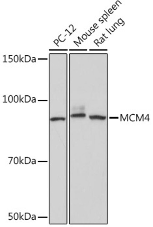 MCM4 Recombinant Rabbit Monoclonal Antibody (ARC1491), Invitrogen 100 ...