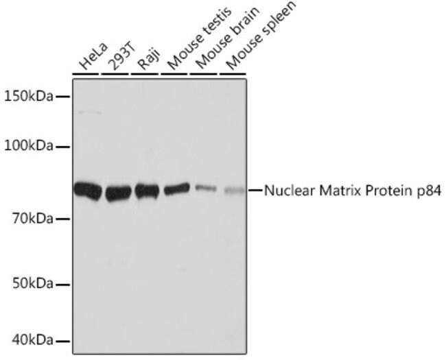 Nuclear Matrix Protein p84 Recombinant Rabbit Monoclonal Antibody ...