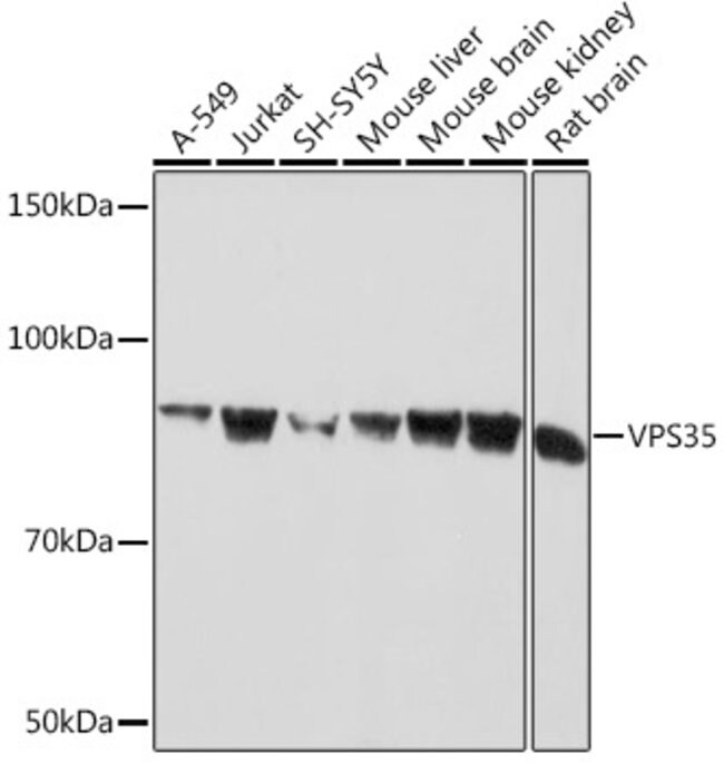 VPS35 Rabbit anti-Human, Mouse, Rat, Unconjugated, Clone: ARC1509 ...