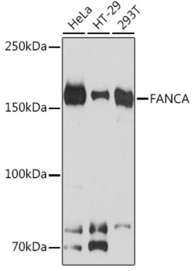FANCA Recombinant Rabbit Monoclonal Antibody (ARC1620), Invitrogen 100 ...
