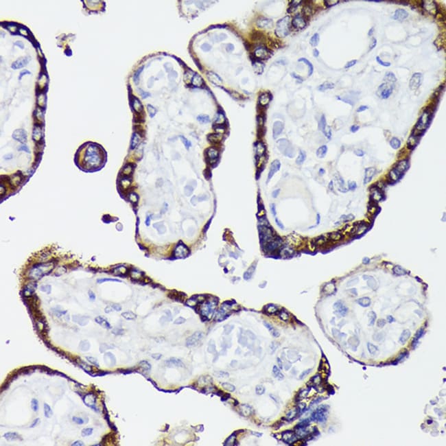 Invitrogen Nectin 2 Recombinant Rabbit Monoclonal Antibody (3H0G2) 100 ...
