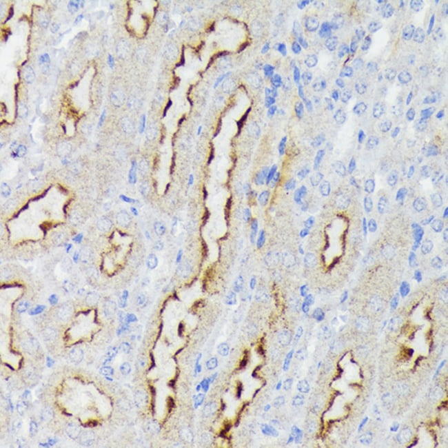 Invitrogen Nectin 2 Recombinant Rabbit Monoclonal Antibody (3H0G2) 100 ...