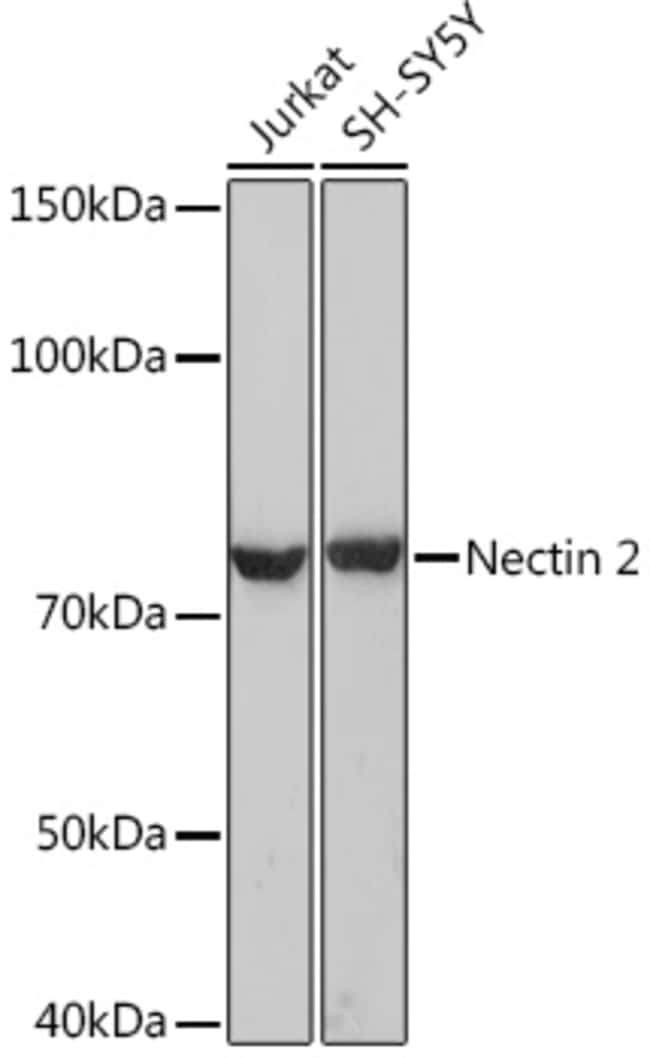 Invitrogen Nectin 2 Recombinant Rabbit Monoclonal Antibody (3H0G2) 100 ...