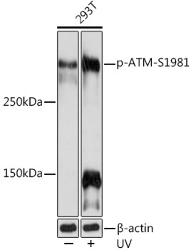 Phospho-ATM (Ser1981) Recombinant Rabbit Monoclonal Antibody (ARC1575 ...