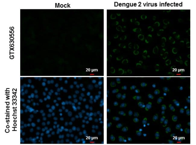 Invitrogen Dengue Virus Type 2 NS1 Monoclonal Antibody (GT4212) 100 μL ...