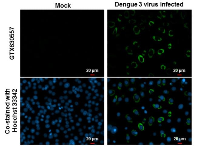 Invitrogen Dengue Virus Type 2 NS1 Monoclonal Antibody (GT1061) 100 μL ...