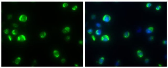 Invitrogen Dengue Virus Type 2 Capsid Monoclonal Antibody (GT574) 100 ...