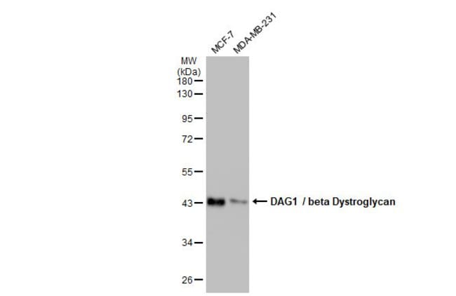 beta Dystroglycan Monoclonal Antibody (GT9112), Invitrogen™ 100 μL ...