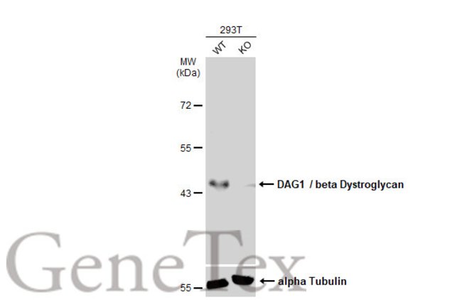 beta Dystroglycan Monoclonal Antibody (GT9112), Invitrogen™ 100 μL ...