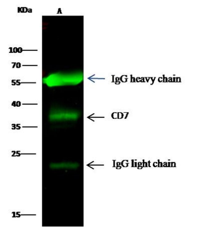 CD7 Recombinant Rabbit Monoclonal Antibody (307), Invitrogen 100 μL ...