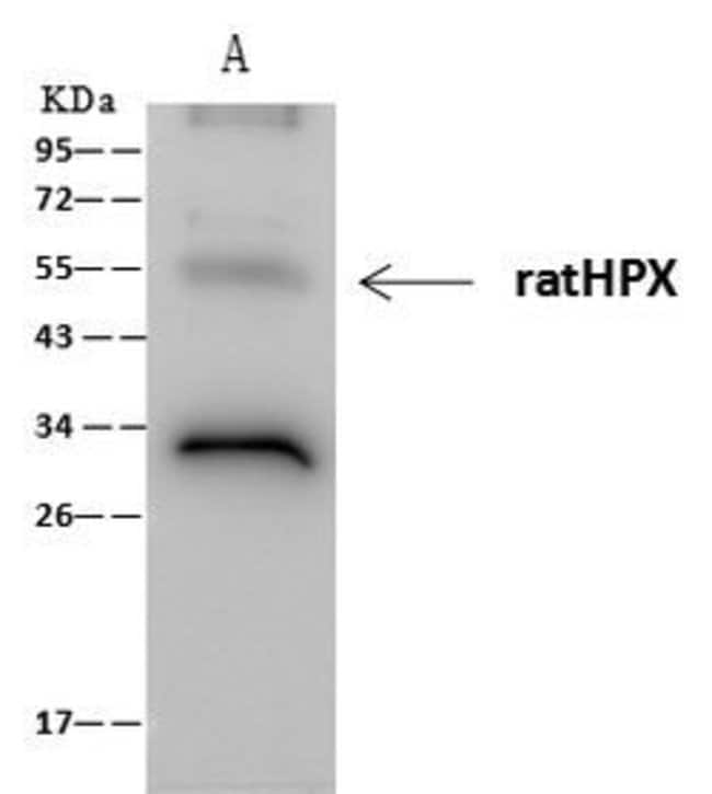 Hemopexin Recombinant Rabbit Monoclonal Antibody (006), Invitrogen 100 ...