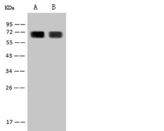 Hemopexin Recombinant Rabbit Monoclonal Antibody (006), Invitrogen 100 ...