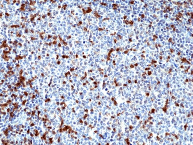 Zap-70 Recombinant Rabbit Monoclonal Antibody (RM408), Invitrogen 100 ...