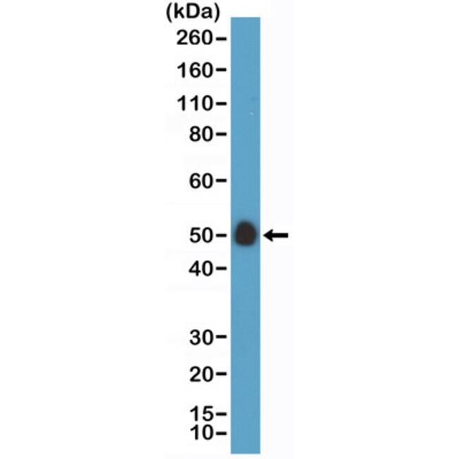CD14 Rabbit anti-Human, Clone: RM415, Invitrogen 100 μL; Unconjugated ...
