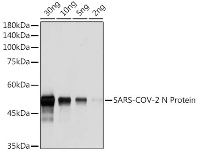 Invitrogen SARS-CoV-2 Nucleocapsid Recombinant Rabbit Monoclonal Antibody | Fisher Scientific