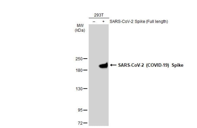 SARS-CoV-2 Spike Protein S1 Monoclonal Antibody (HL263), Invitrogen 100 | Fisher Scientific