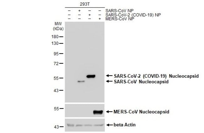 SARS-CoV-2 Nucleocapsid Monoclonal Antibody (HL146), Invitrogen 100 μL; | Fisher Scientific
