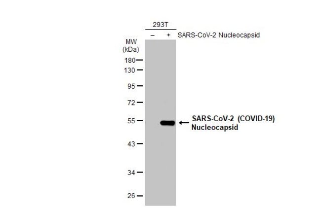 SARS-CoV-2 Nucleocapsid Recombinant Rabbit Monoclonal Antibody (HL146), | Fisher Scientific