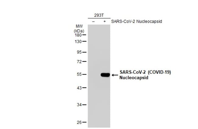 Invitrogen SARS-CoV-2 Nucleocapsid Recombinant Rabbit Monoclonal Antibody | Fisher Scientific