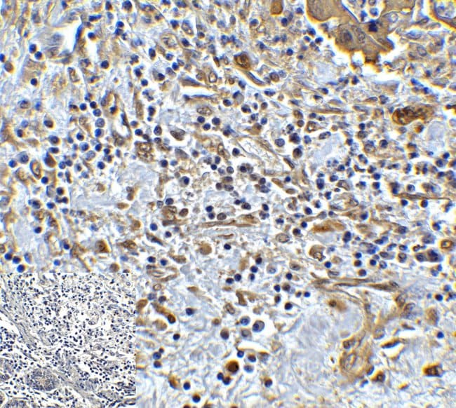 TMIGD2 Monoclonal Antibody (8G1), Invitrogen 100 μg; Unconjugated ...