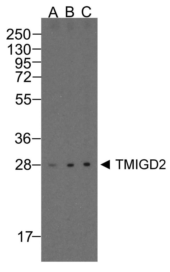 TMIGD2 Monoclonal Antibody (8G1), Invitrogen 100 μg; Unconjugated ...
