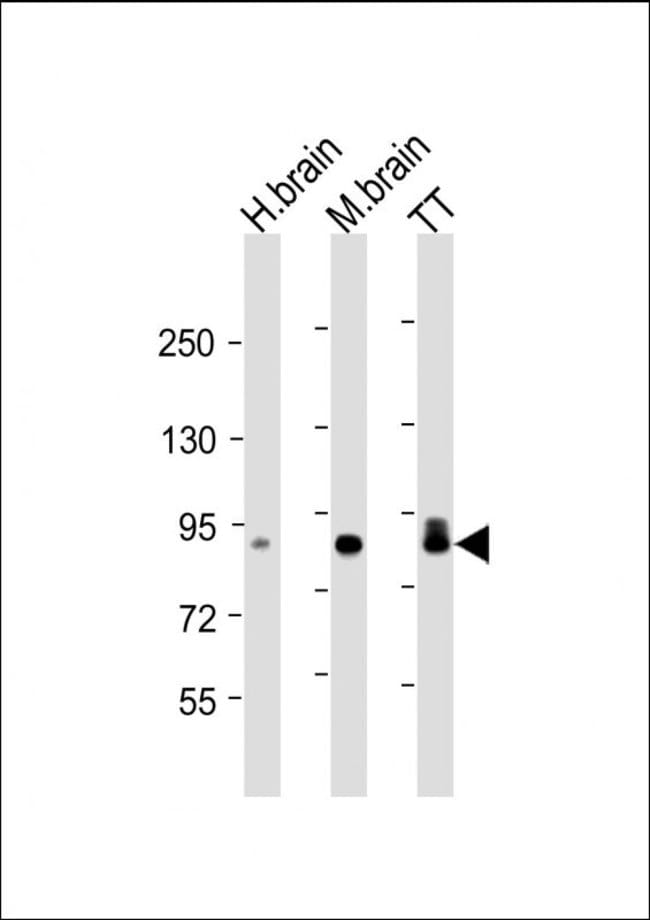 Invitrogen DCLK1 Monoclonal Antibody (1751CT665.1.72) 200 μL ...