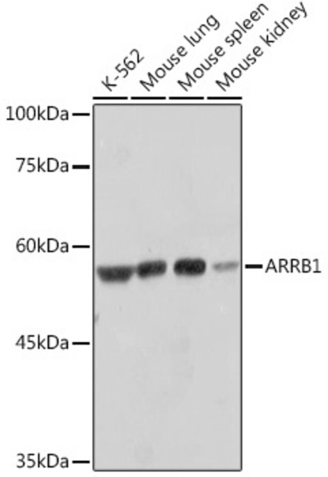 beta Arrestin 1 Rabbit anti-Human, Human, Mouse, Clone: ARC2370 ...