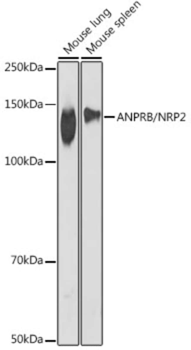 Invitrogen Npr2 Recombinant Rabbit Monoclonal Antibody (1S1H1) 100 μL ...