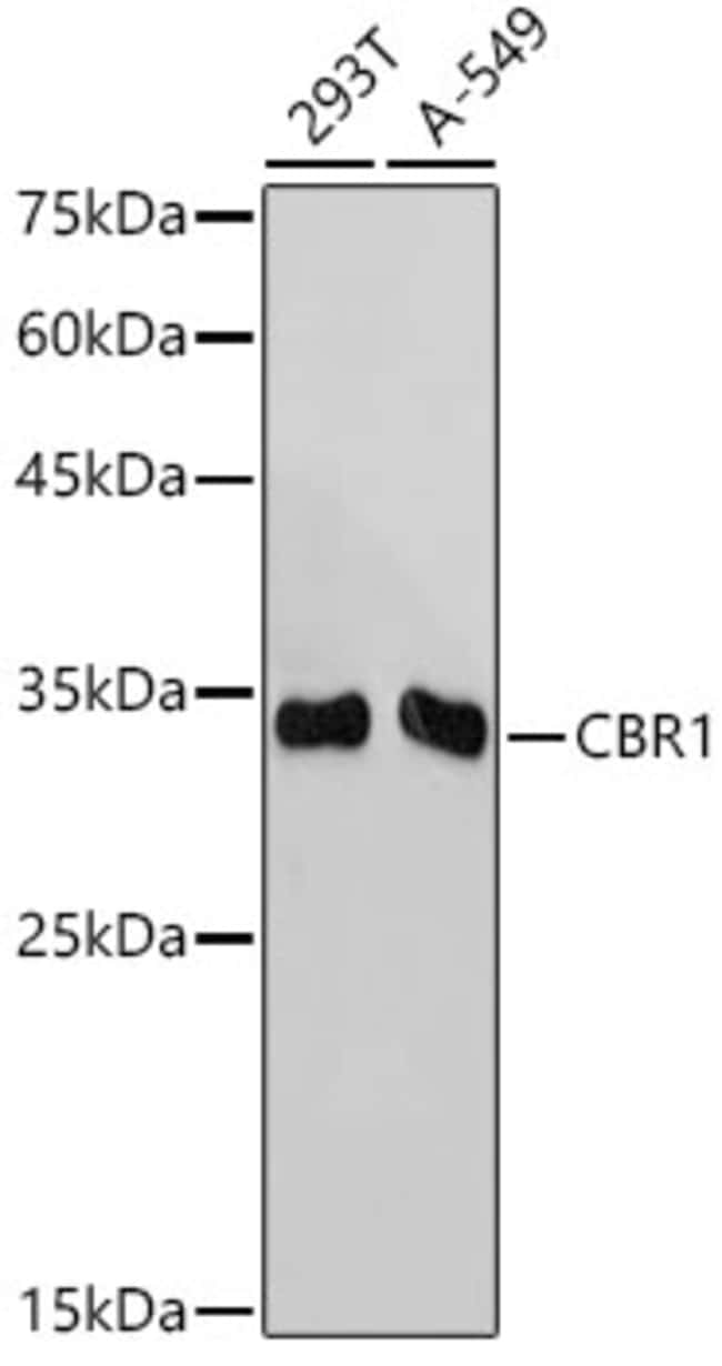 Invitrogen CBR1 Recombinant Rabbit Monoclonal Antibody (3A9O5) 100 μL; | Fisher Scientific