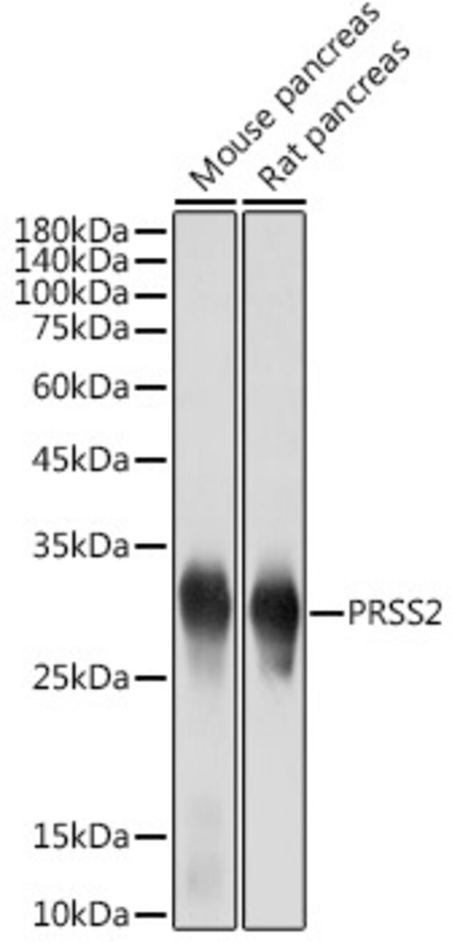 Trypsin 2 Recombinant Rabbit Monoclonal Antibody (ARC2453), Invitrogen ...
