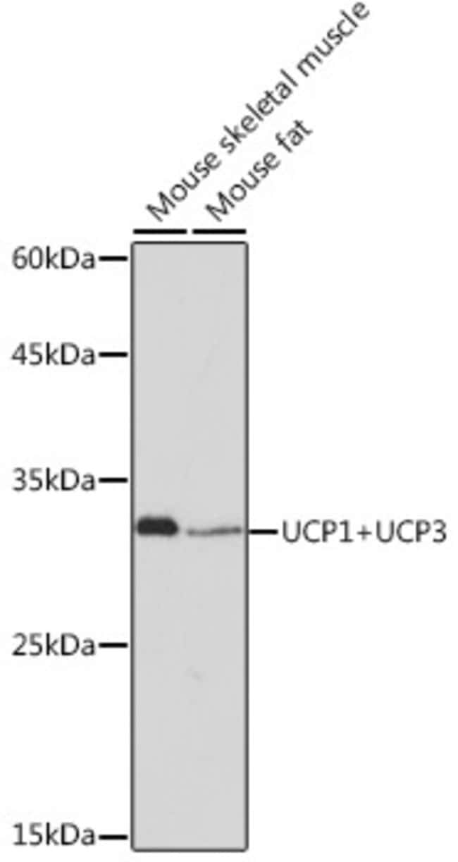 UCP1/UCP3 Recombinant Rabbit Monoclonal Antibody (ARC2304), Invitrogen ...