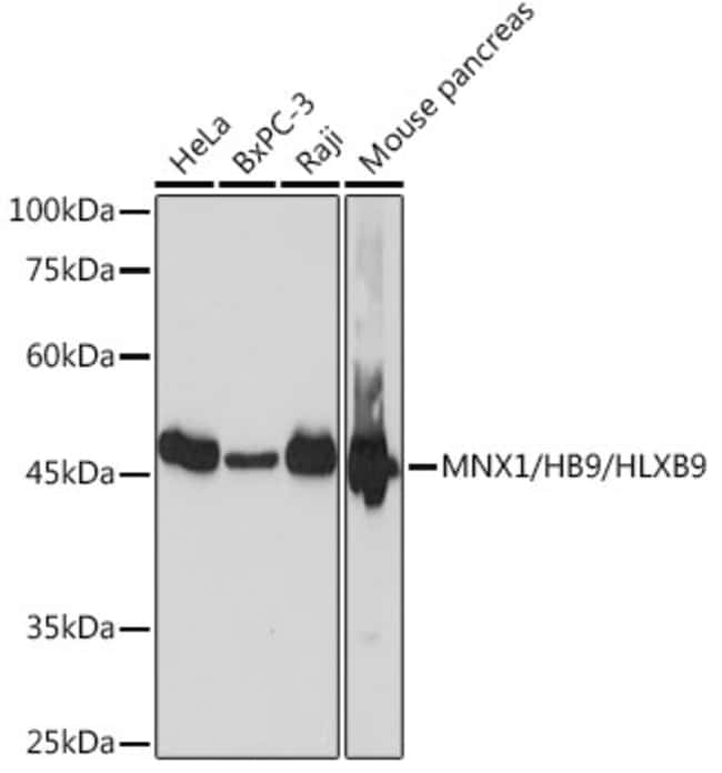 Invitrogen HB9 Recombinant Rabbit Monoclonal Antibody (9P1B7) 100 μL; | Fisher Scientific