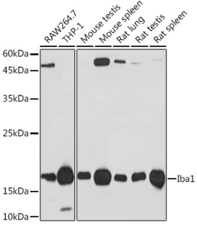 IBA1 Recombinant Rabbit Monoclonal Antibody (ARC2301), Invitrogen 100 ...