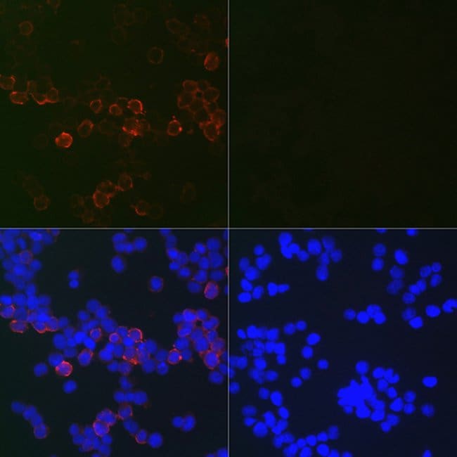 SARS-CoV-2 Spike Protein (RBD) Mouse anti-Virus, Clone: nan, Invitrogen ...